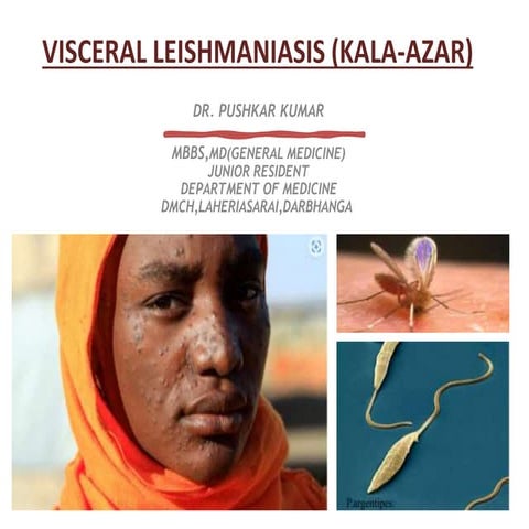 Kala azar.pptx
