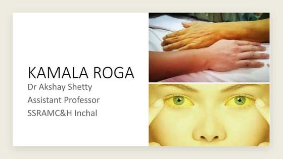 Raktapitta | रक्तपित्त | Hemorrhagic Disorders | HBD | Complete Lecture ...