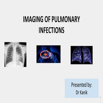 Radiographic manifestations of pulmonary tuberculosis | PPTX