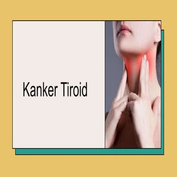 Kanker Tiroid.pptx