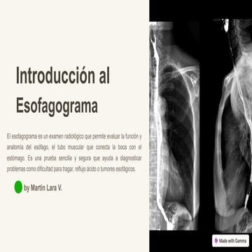 Introduccion al esofagograma y sus características | PPTX