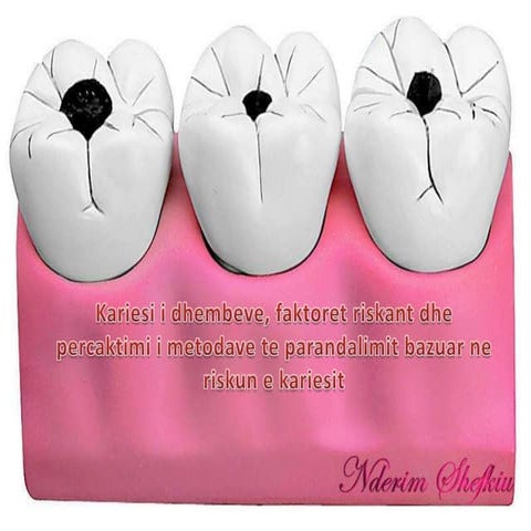 Kariesi i dhembeve dhe parandalimi i bazuar ne riskun e kariesit | PPTX