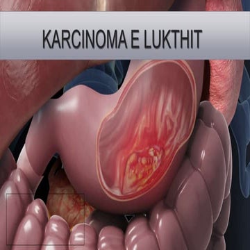 KARCINOMA E LUKTHIT-punim seminarik (per fakultetin mjekesise) | PPTX