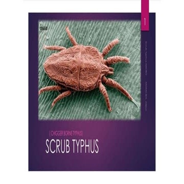 Srub typhus department of microbiology.pptx