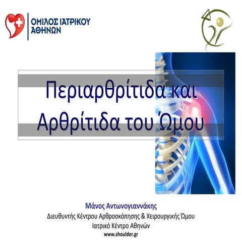 αντίκυρα 2015 αρθρίτιδα και περιαρθρίτιδα ώμου | PPT