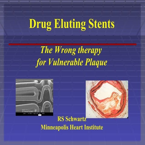 122 drug eluting stents | PPT