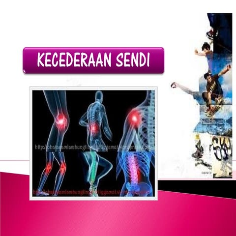 Kecederaan sendi 2 | PPT
