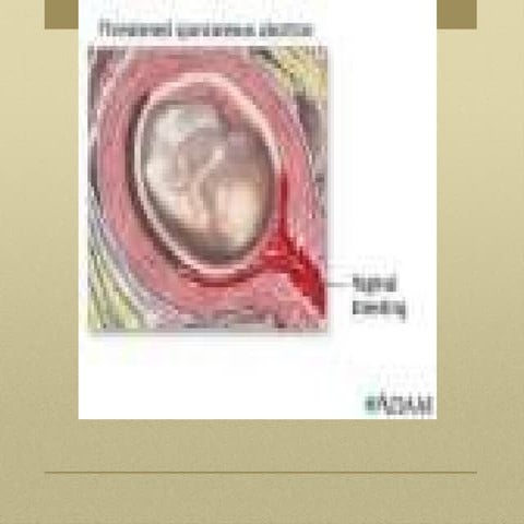 KEGUGURAN | PPT