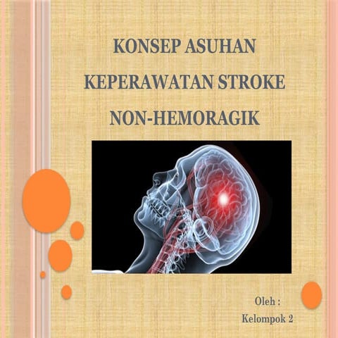 KEL 2 _ KONSEP ASKEP STROKE NON-HEMORAGIK.pptx