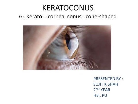 Keratoconus , symptoms , types & treatment | PPT