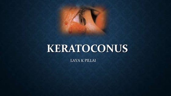 Keratoconus | PPT | Eye and Vision Conditions | Diseases and Conditions