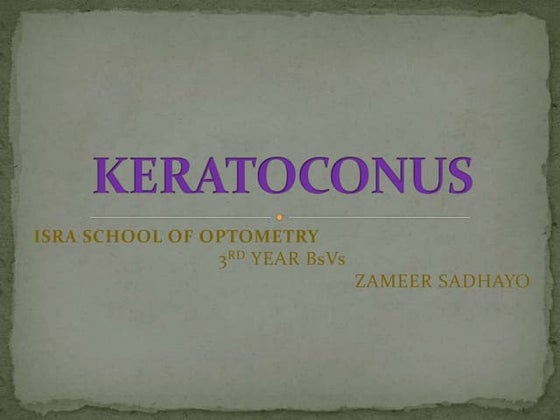 18Corneal Ectasias.ppt1234567890-0oiuytrewe45 | PPT