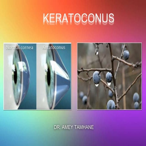 A case presentation on Keratoconus - by Ashi | PPTX
