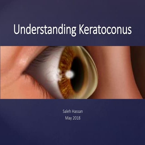 Keratoconus Presentation Ppt