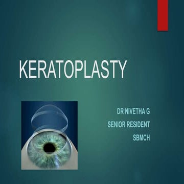 KERATOPLASTY by arthur mohan and niko.pptx | Free Download