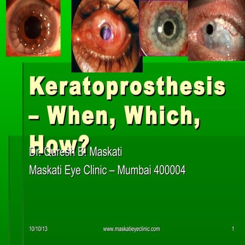 Keratoprosthesis – when, which, how 2013 | PPT
