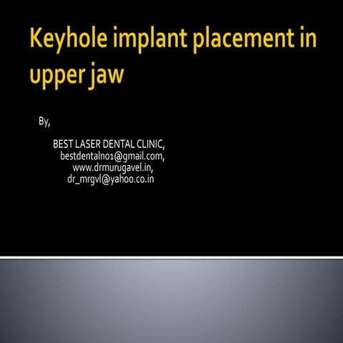 Keyhole implant placement in upper jaw | PPTX