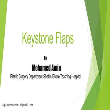 Keystone flaps | PPTX