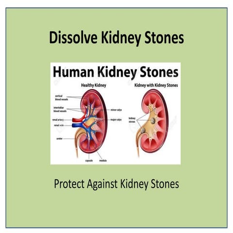 kidneystone1.pptx