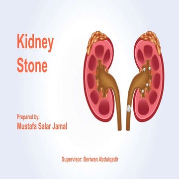 Presentation kidney-stone final | PPTX