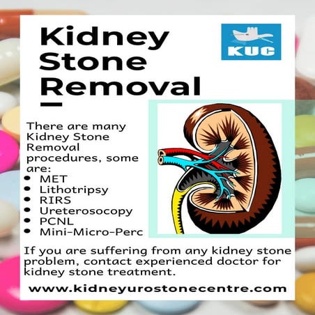 Kidney Stone Removal | PDF