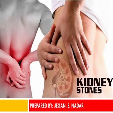 Pathophysiology of Kidney stones | PDF