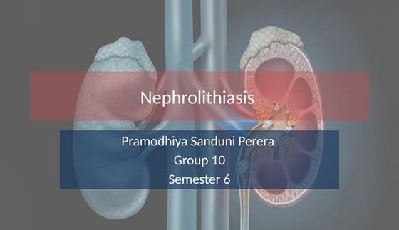 Nephrolithiasis, Diagnosis and Management: A Review Article | PDF ...