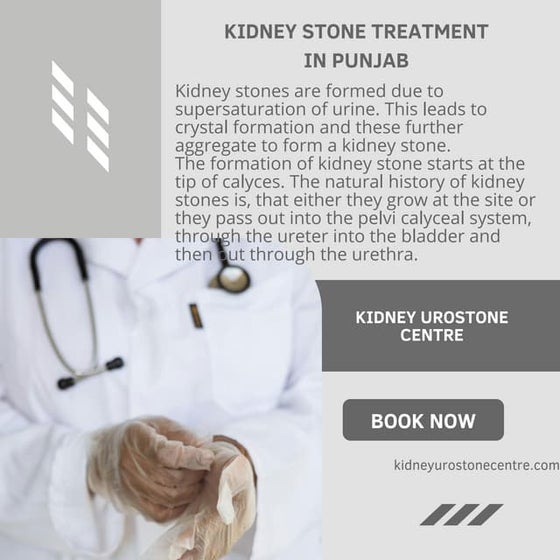 Kidney Stone Removal | PDF