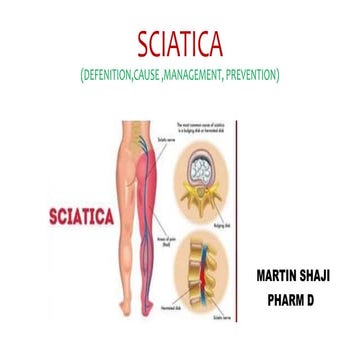 a study on sciatica | PPTX