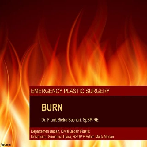 Burn_dr_Frank_terbaru_kali.pptx