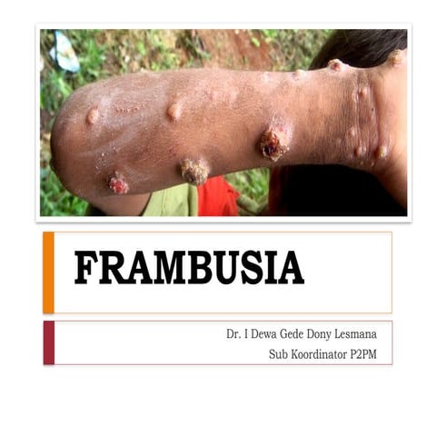Tata Laksana Klinis Penyakit Frambusia | PPTX
