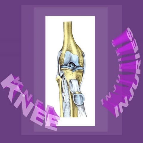 Knee Clinical anatomy (injury) | PPTX