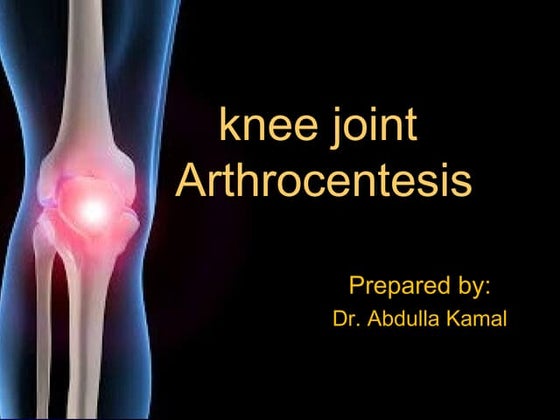 Arthrocentesis | PPT