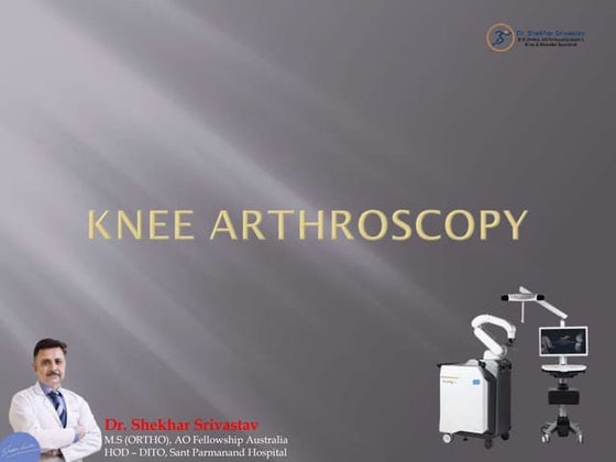Shoulder arthroscopy surgery | PPT