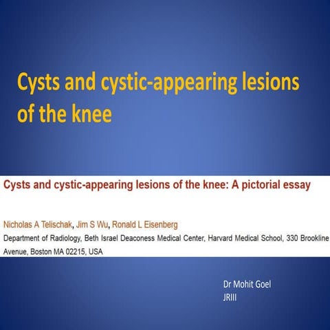 Knee cystic lesions | PPTX