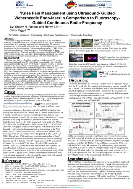Ultrasonography guided pulsed radio frequency in comparison to fluoroscopy-guided conventional ...