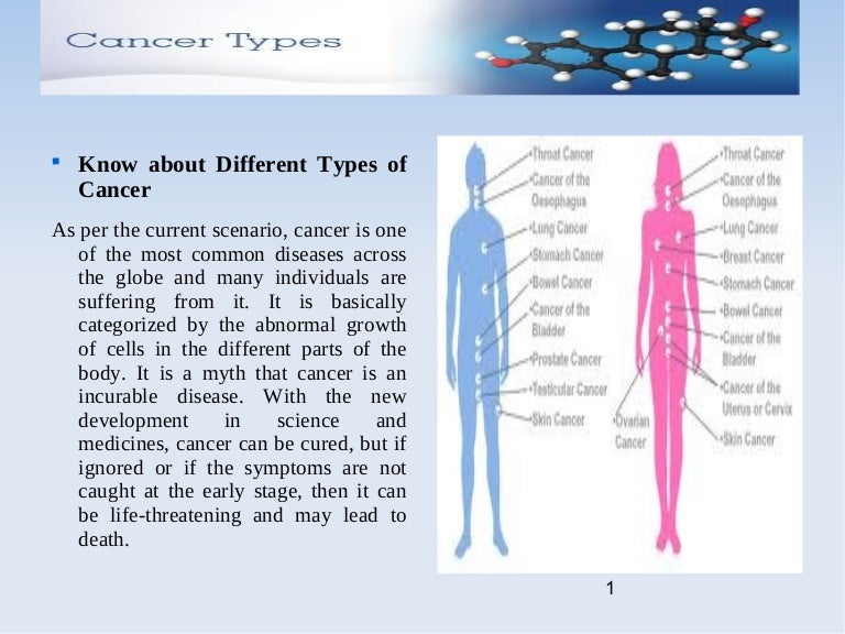 Know about different types of cancer