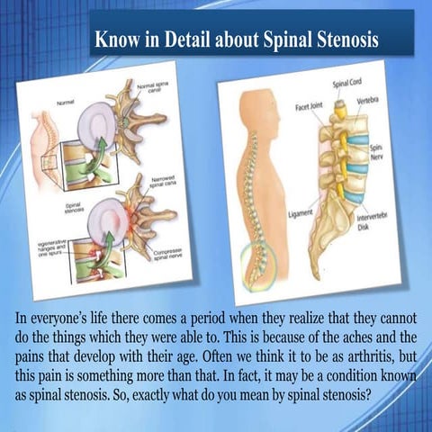 Cervical spinal stenosis surgery