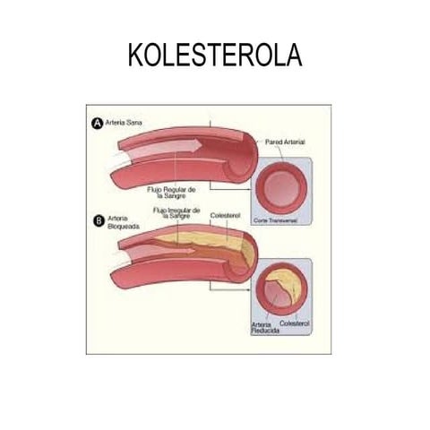 Kolesterola | ODP