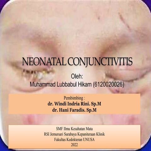 Conjungtivitis Neonatorum /Neonatal.pptx