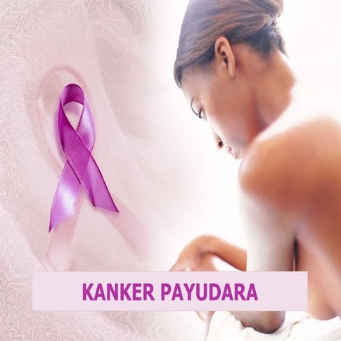 KONSEP KANKER PAYUDARA PPT.pptx