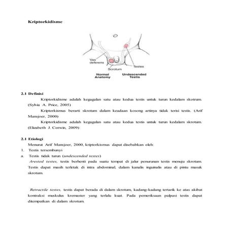 Kriptorkidisme | DOCX