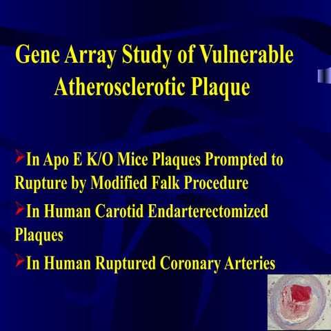 Gene array study of vp | PPT