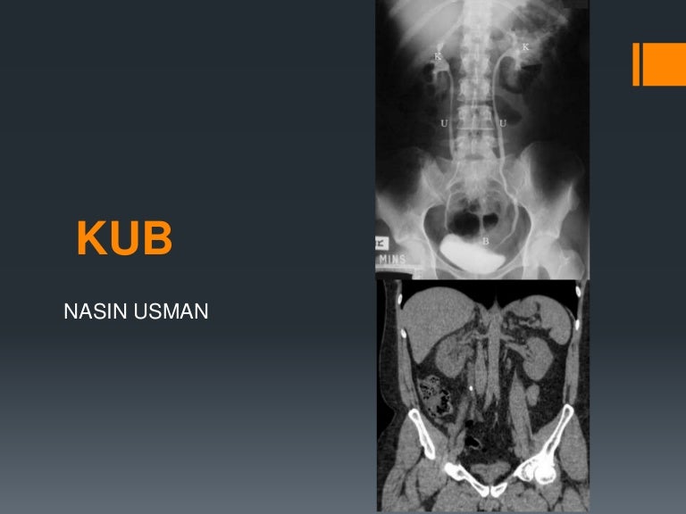 kub-xray-and-usg