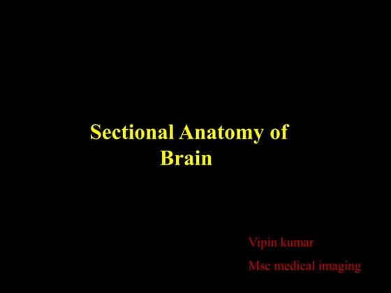 MIDBRAIN basic anatomy and applied aspects. | PPT