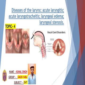 Kunal Singh .Topic-4.Diseases of the larynx.ENT.GM20-148.pptx
