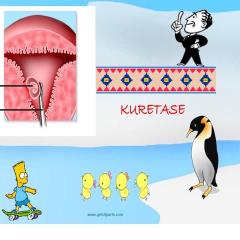 Prosedur kuretase, LANGKAH KLINIK, PERAWATAN PASCATINDAKAN | PPTX