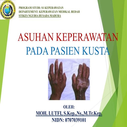 asuehan keperawatan pada pasien dengan penyakit kusta | PPTX