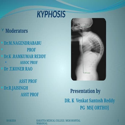KYPHOSIS.pptx KYPHOSIS DEFORMITY OF THE SPINE | PPTX