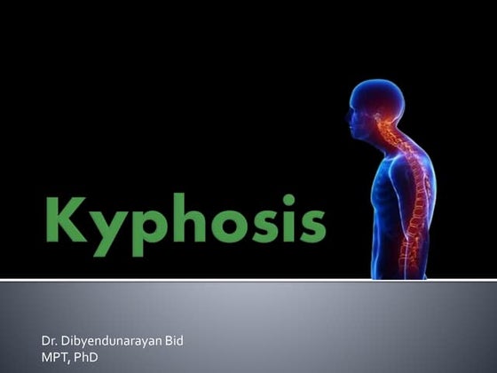 Kyphosis | PPT